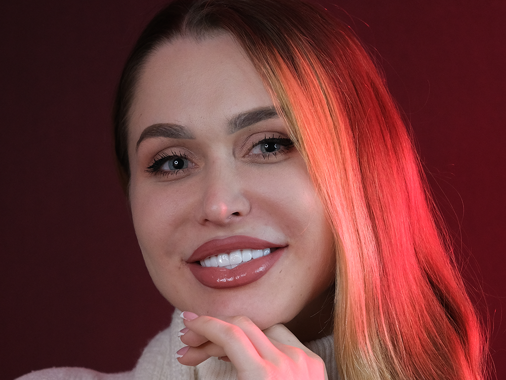 Veneer Application (Leaf Teeth) - Bagcilar Dental Clinic